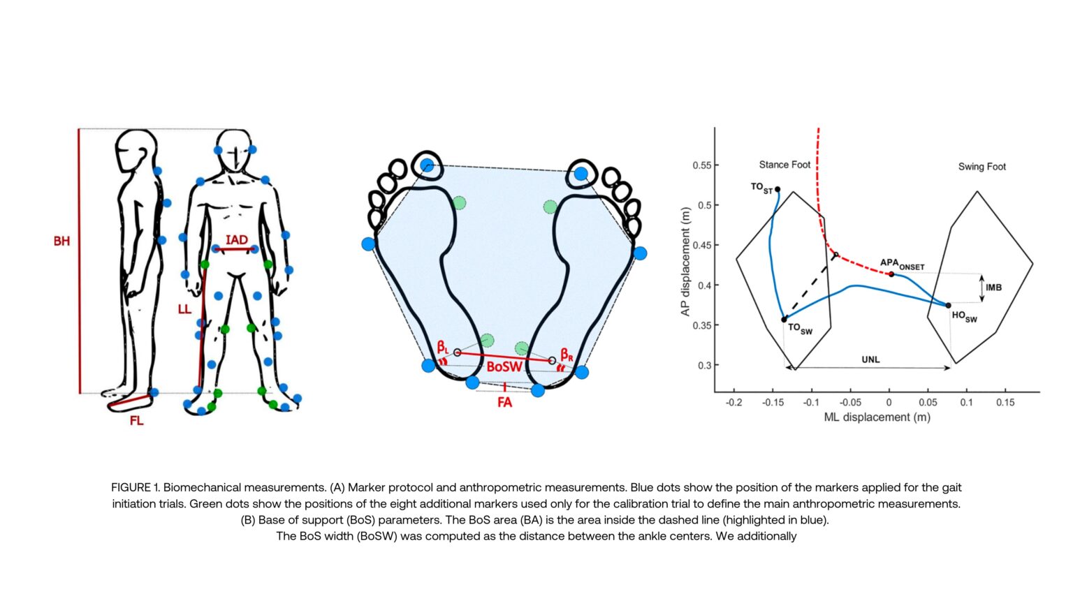 Gait Initiation in Parkinson’s Disease analyzed using BTS gait lab